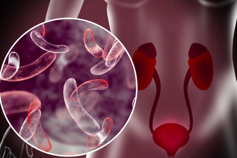 Infecciones de orina recurrentes: causas, síntomas y tratamientos
